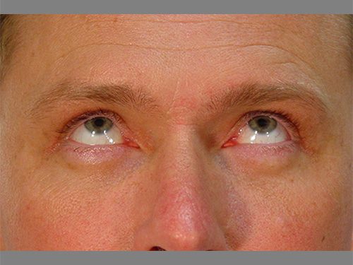 Before and After Case #8670 Photos | Birmingham, AL | Grotting Plastic ...