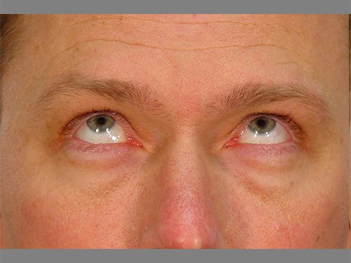Before and After Case #8670 Photos | Birmingham, AL | Grotting Plastic ...