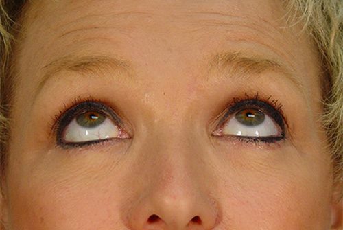 Before and After Case #2949 Photos | Birmingham, AL | Grotting Plastic ...